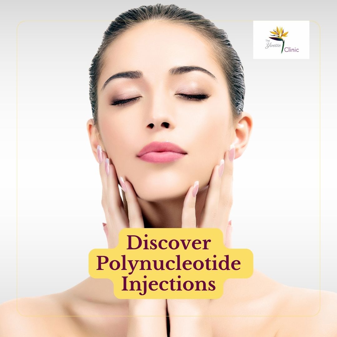 The Power of Polynucleotide Injections: Now available at The Yvette Cl ...